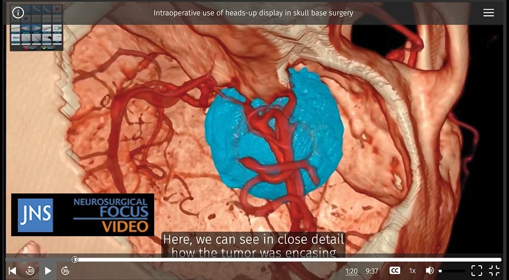 Scholarly Video: a Case Study - KnowledgeWorks Global Ltd